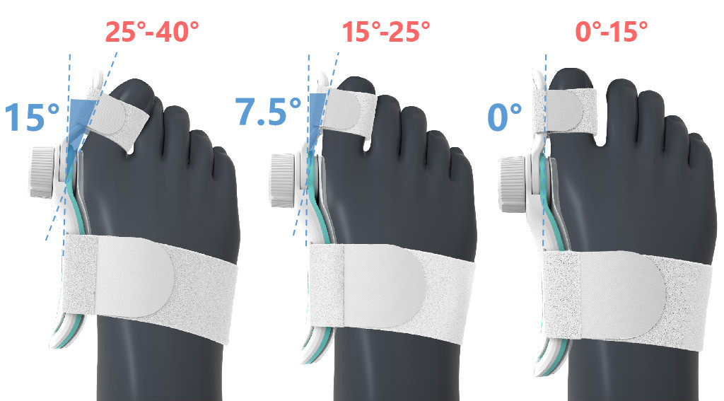Aparat ortopedic pentru hallux valgus Tenicore XH | Fabulo.ro